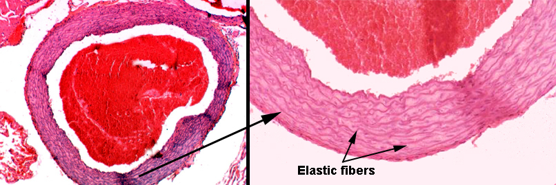 Muscular Artery Vs Elastic Artery Histology
